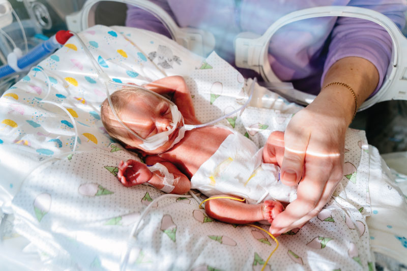 A closer look at the effects of chorioamnionitis on premature babies ...